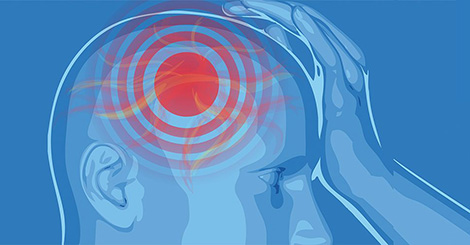 Cefalea: alleviare il mal di testa con rimedi erboristici naturali
